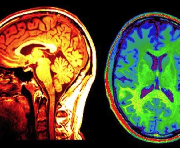 MDMA May Treat PTSD By Re Opening Sociable Window - FeedMass